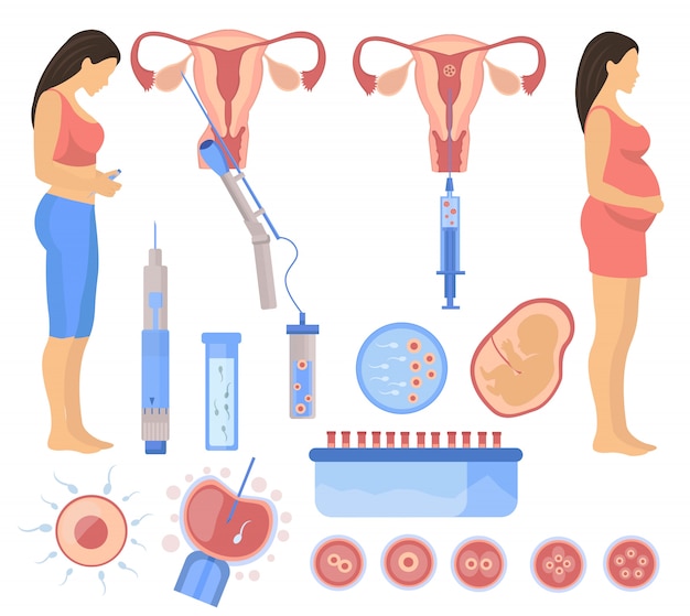 In vitro fertilization flat elements | Free Vector In vitro fertilization flat elements | Free Vector