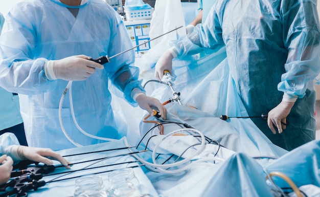 Proces Van Gynaecologische Chirurgie Met Laparoscopische Apparatuur
