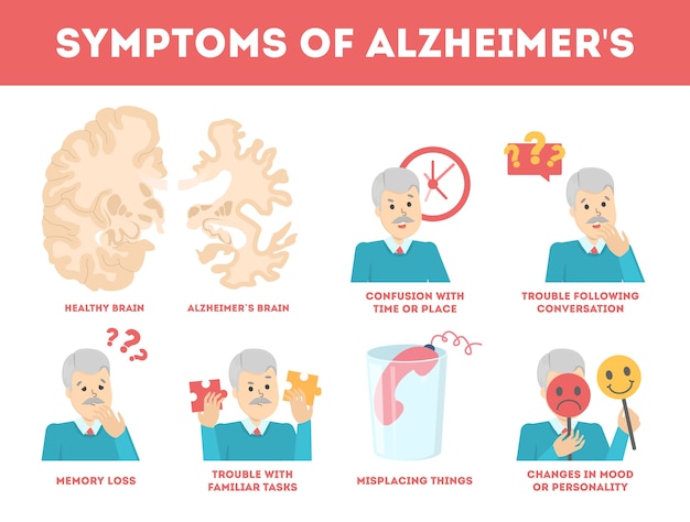 Symptomen van de ziekte van alzheimer infographic. geheugenverlies en ... Symptomen van de ziekte van alzheimer infographic. geheugenverlies en ...